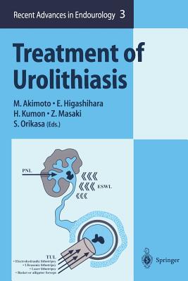 Urolithiasis