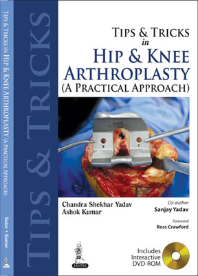 Tips and Tricks in Hip and Knee Arthroplasty: (A Practical Approach ...