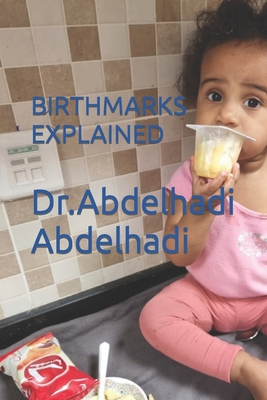 Birthmarks Explained (Paperback) | Children's Book World