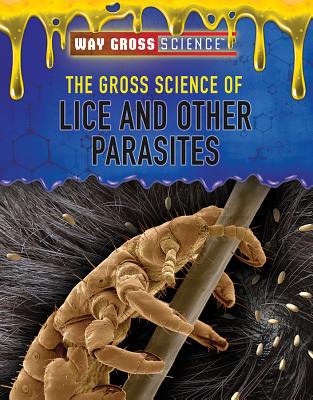 The Gross Science of Lice and Other Parasites (Way Gross Science ...