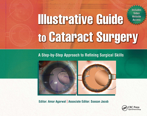 Illustrative Guide to Cataract Surgery: A Step-by-Step Approach to ...