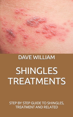 Treatment For Shingles